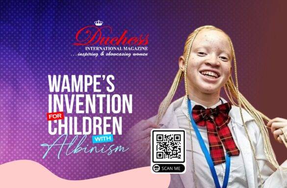 Wampe’s Invention for Children with Albinism | Duchess International ...